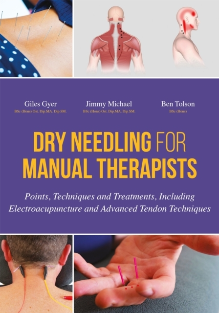 Dry Needling for Manual Therapists af Giles Gyer,Jimmy Michael,Ben ...
